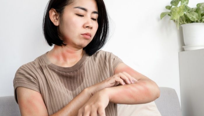 Impact of Fibromyalgia Rash on Your Skin