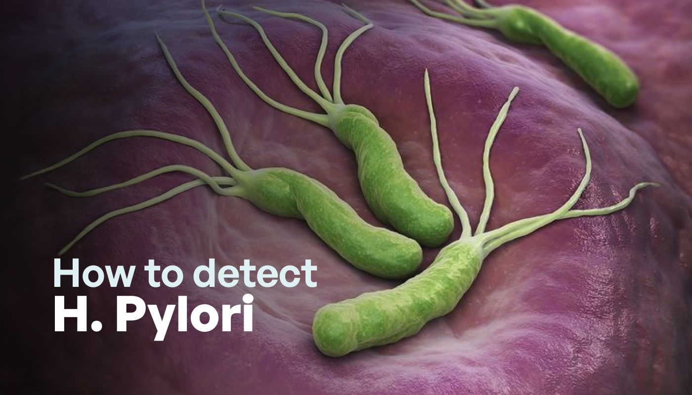 What is H. Pylori? Symptoms, Natural Treatment & Prevention
