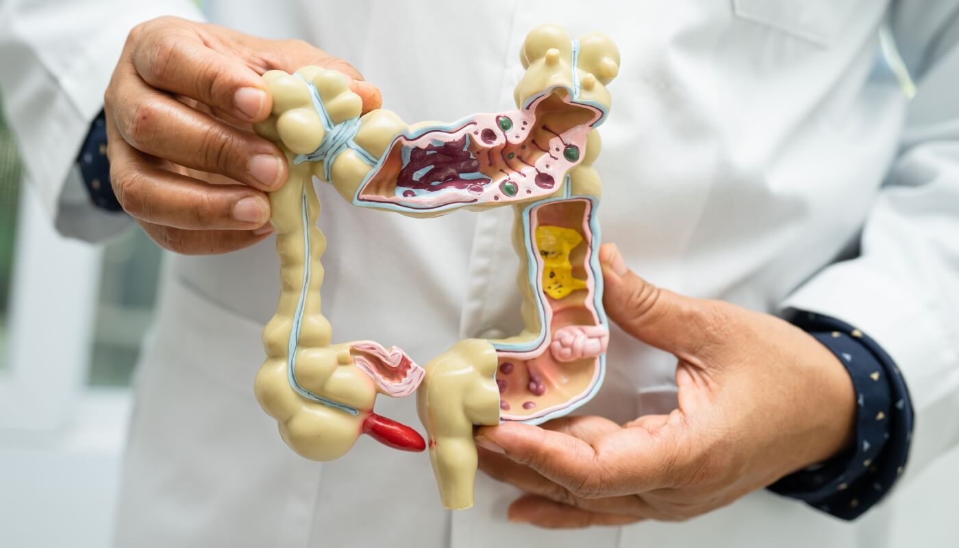 Gut Types Explained: How to Know Your Gut Type?